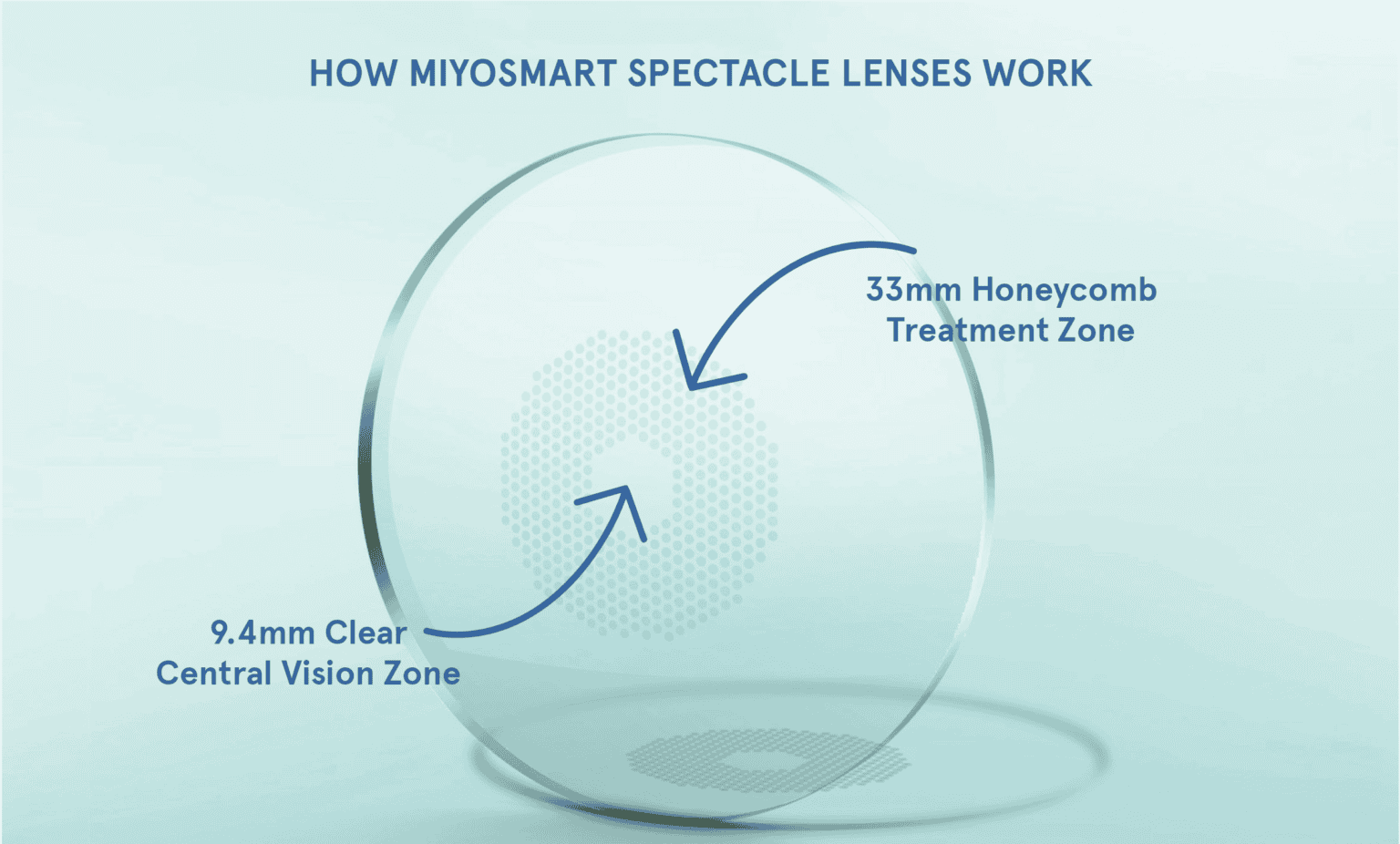 MiYOSMART Lenses | Slow Your Child's Myopia by Up to 60% | Eye Care for ...