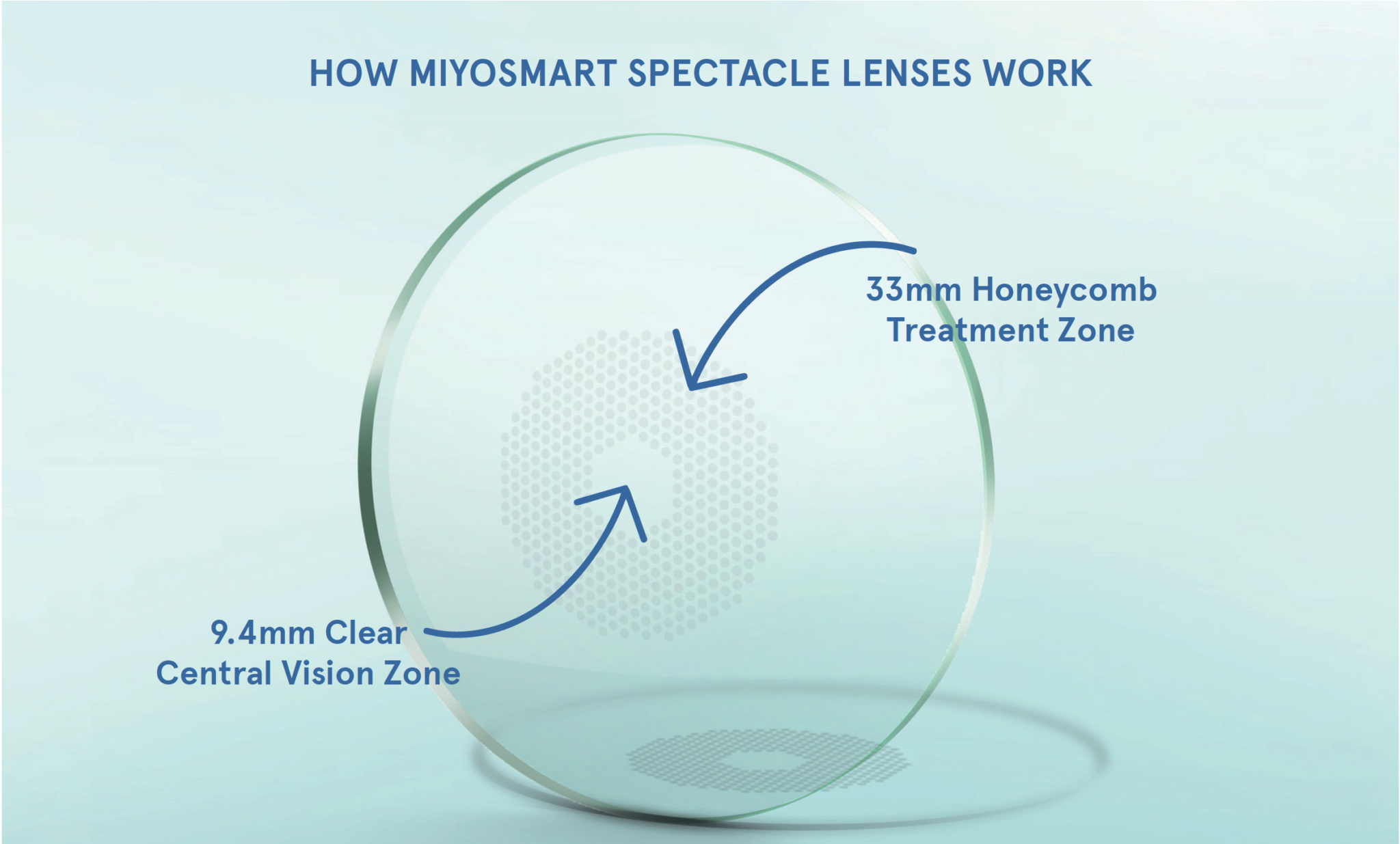 MiYOSMART lenses - Eye Care for Kids